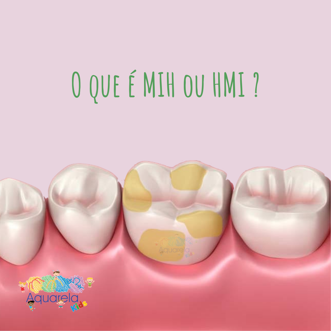 MIH ou HMI - Hipomineralização dos Molares e Incisivos - Aquarela ...